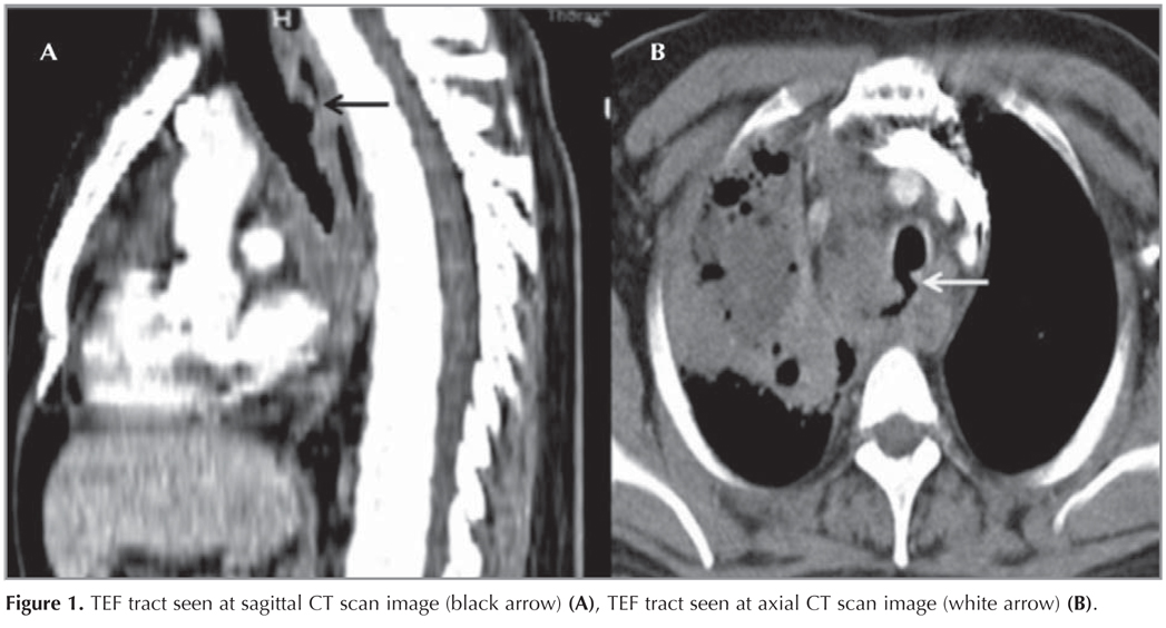 ?zge ?ZT?RK1, Deniz K?KSAL1, Salih EMR?1