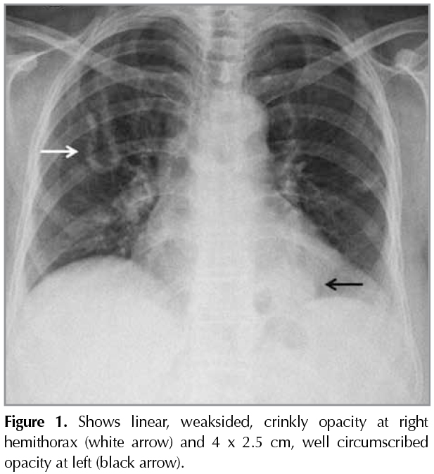 Let's get estimates!
